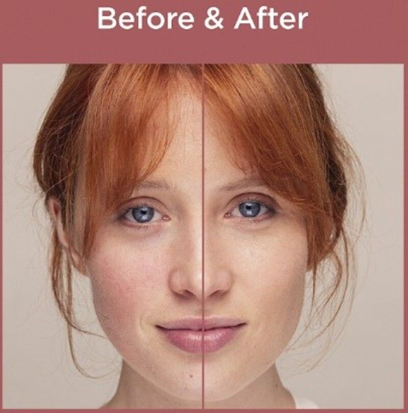 Isdin FotoUltra Слънцезащитен флуид Redness, SPF 50+, 50 ml | Ozone.bg