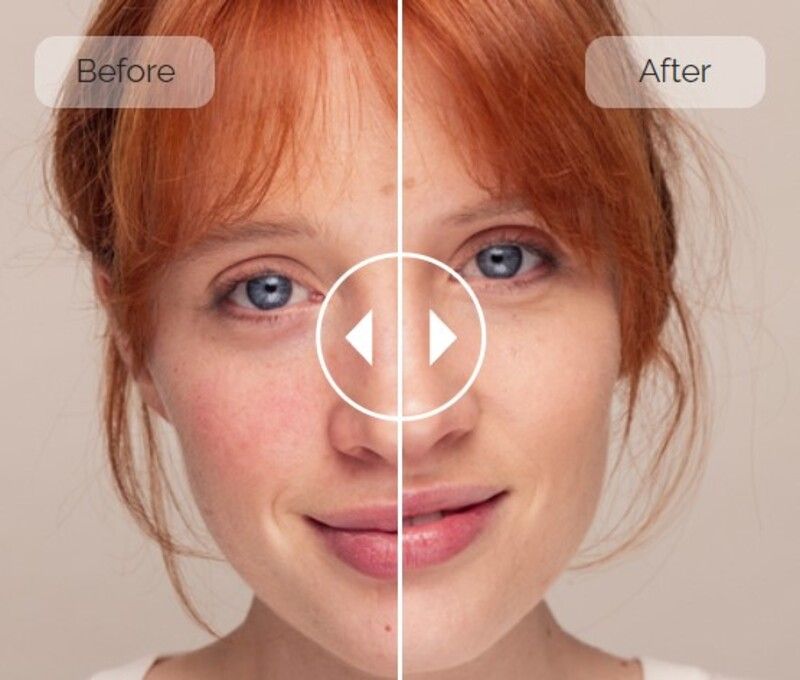 Isdin FotoUltra Слънцезащитен флуид Redness, SPF 50+, 50 ml | Ozone.bg